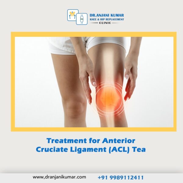 Treatment for Anterior Cruciate Ligament (ACL) Tear - Dr.Anjani Kumar ...
