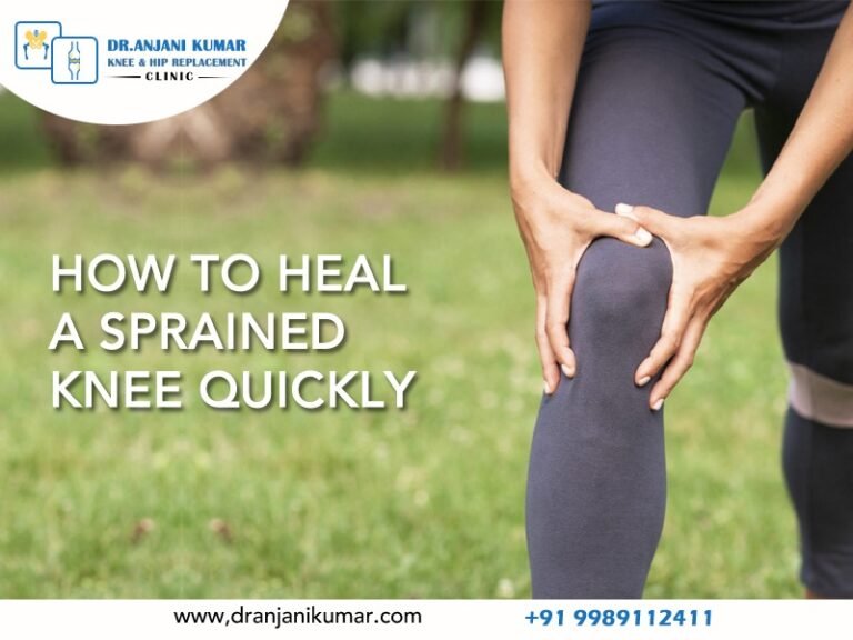How to heal a sprained knee quickly - Dr.Anjani Kumar -Orthopaedic surgeon