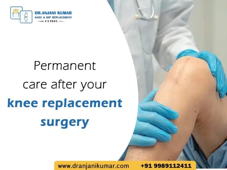 Permanent care after your knee replacement surgery - Dr.Anjani Kumar ...